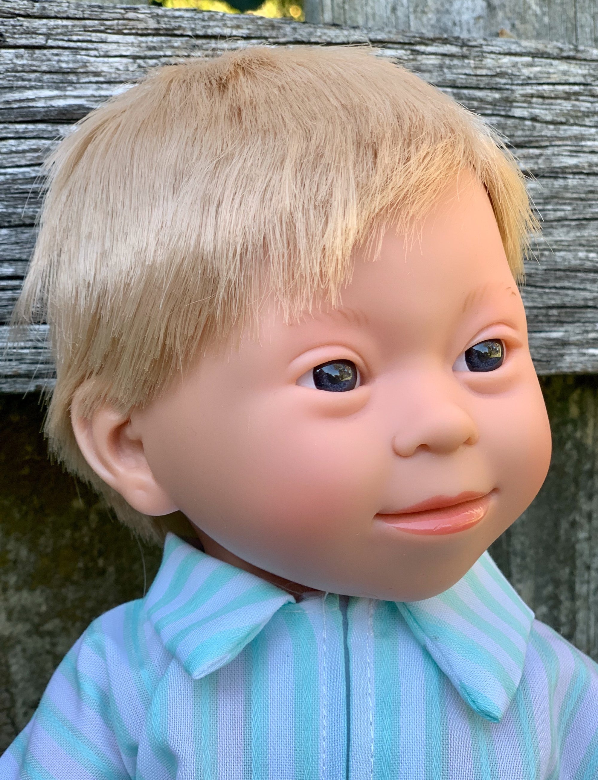 Baby Boy Billy with Down Syndrome Features | Verde Baby